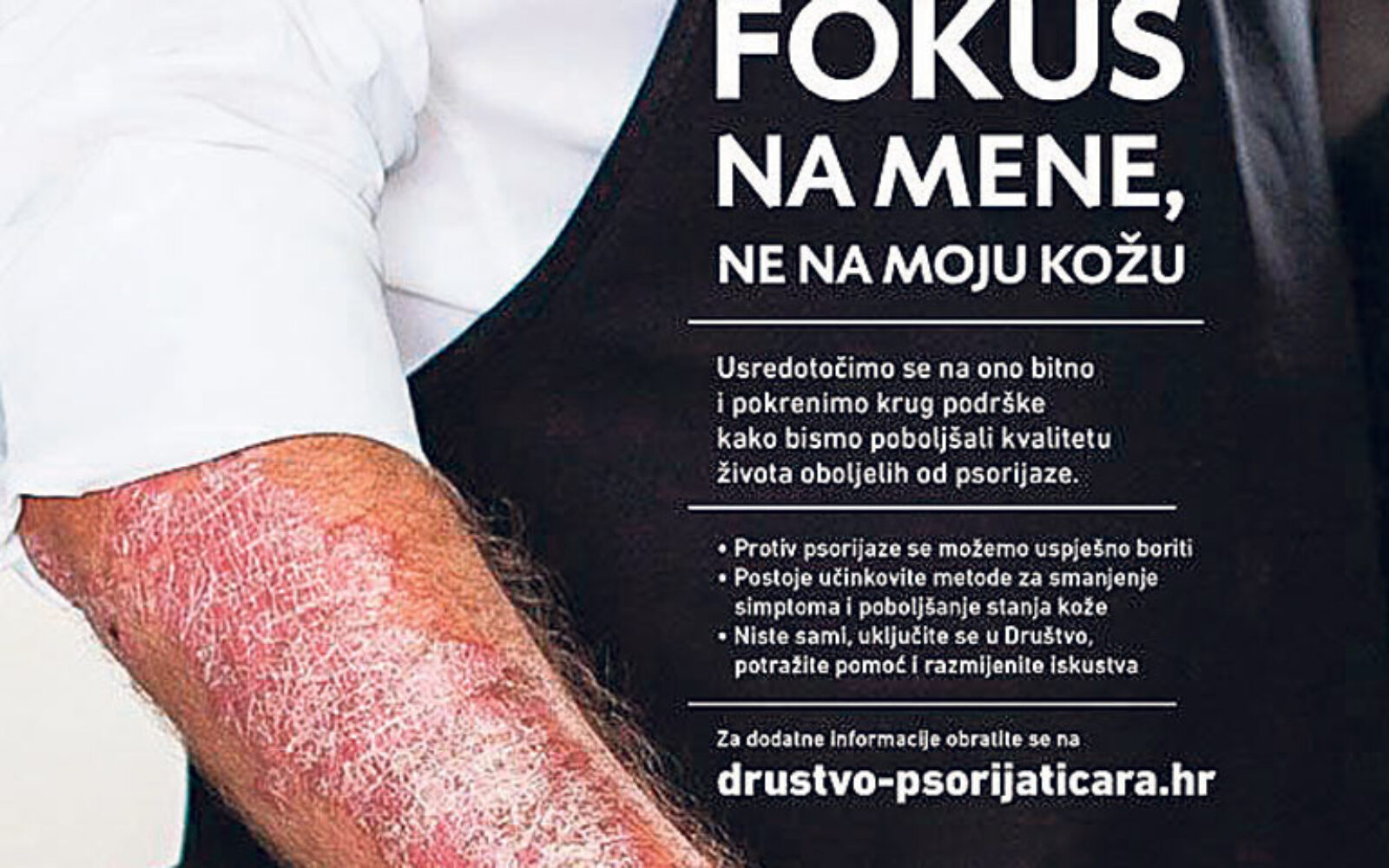 Predrasude o bolesti i bolesnicima - Poslovni dnevnik